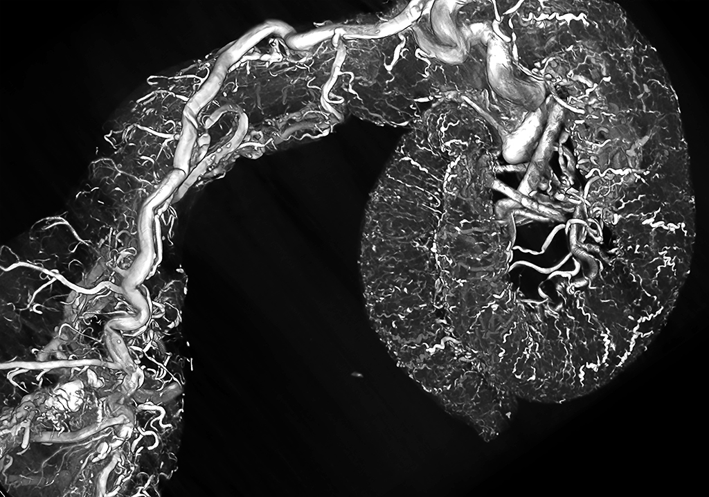 Bearded Dragon Intestines Perfused with BriteVu - BriteVu